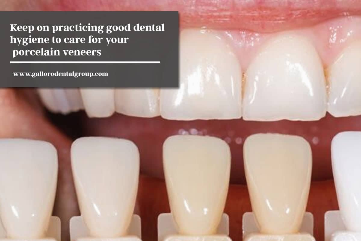 Getting Porcelain Veneers | Galloro Dental Group